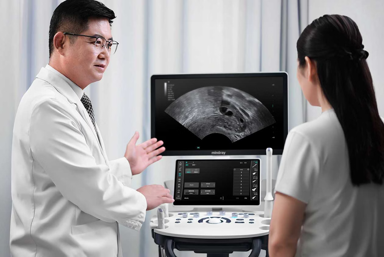 Mindray Consona N6 Ultrasound Machine - 121-002766-00 - MARS