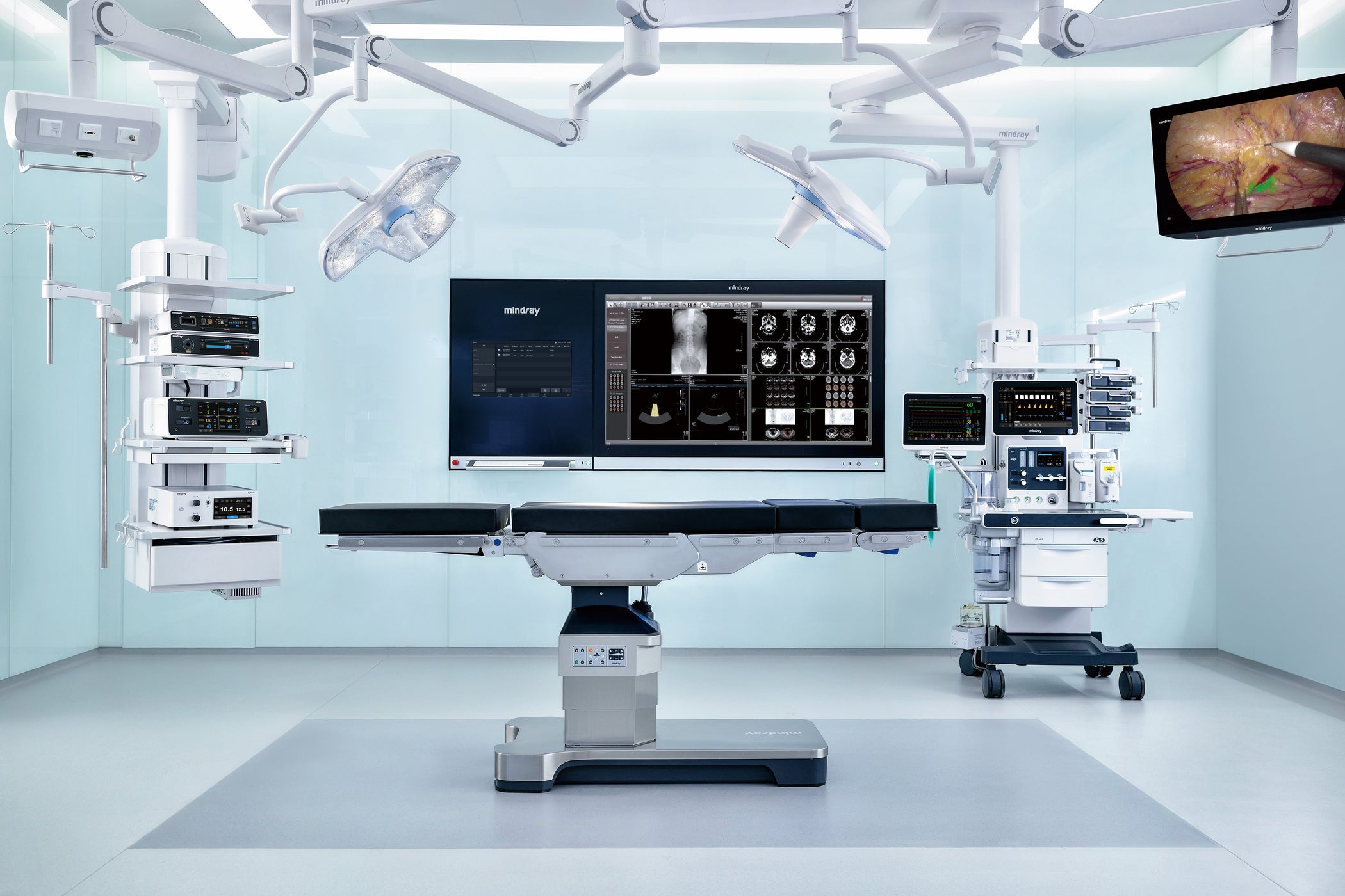 Mindray HyBase V6 Operating Table - 121-002774-00 - MARS